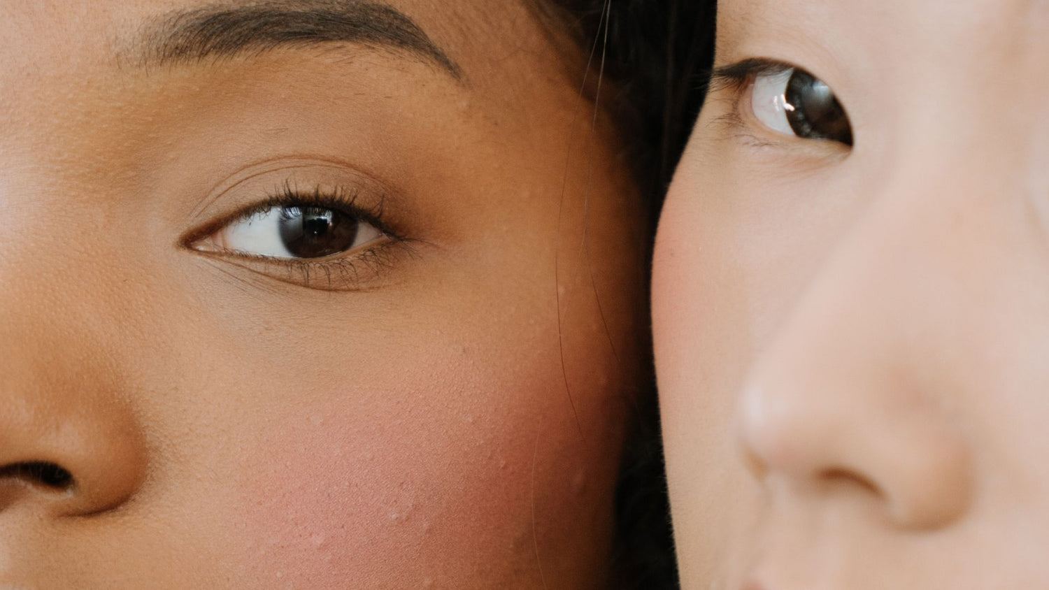 How acne positivity can help heal your skin – DemarkQ